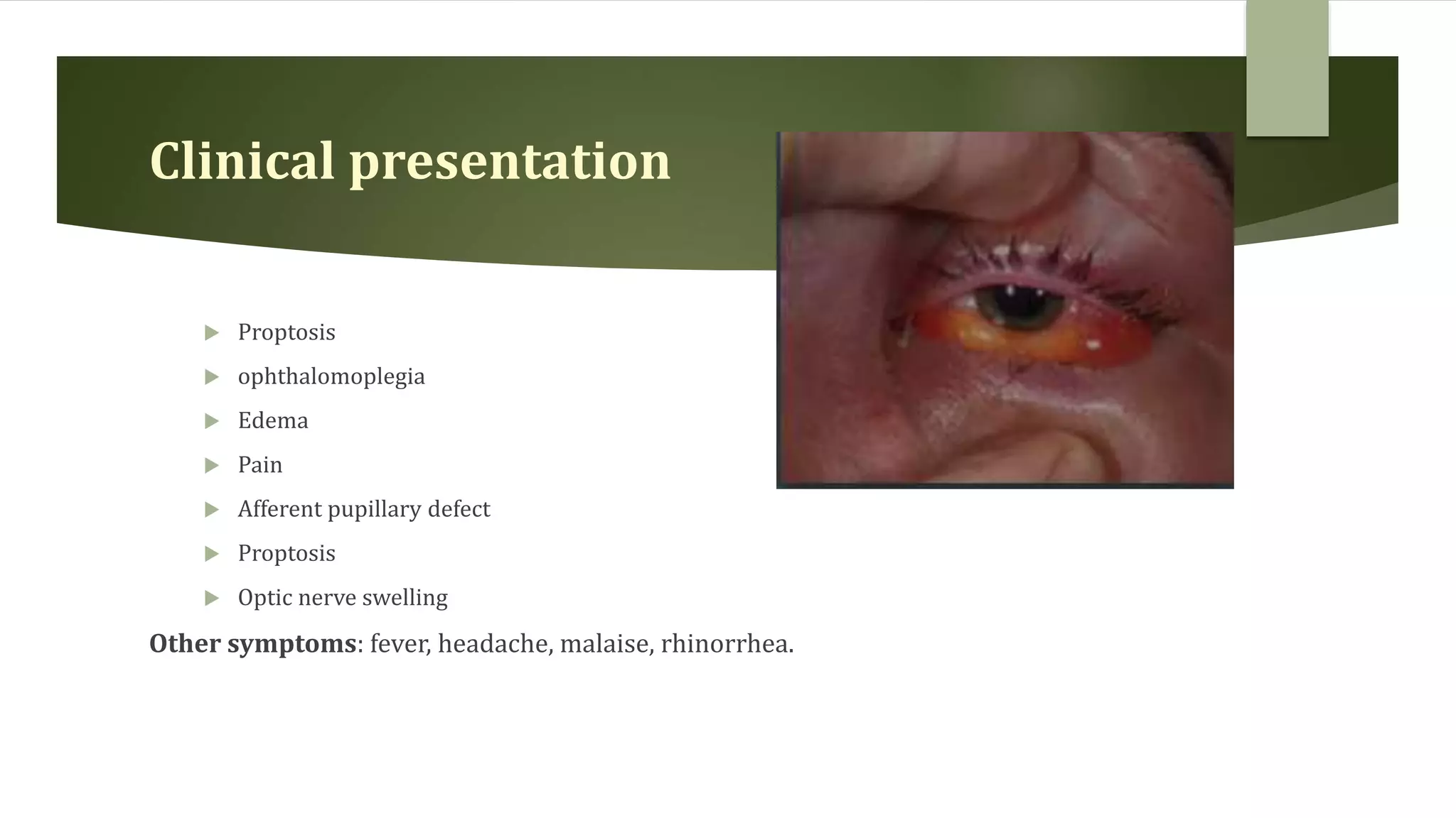 orbital cellulitis.pptx
