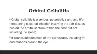 Orbital Cellulitis.pptx Orbital Cellulitis | PPTX