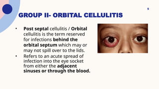 Orbital cellulitis brief description.pptx