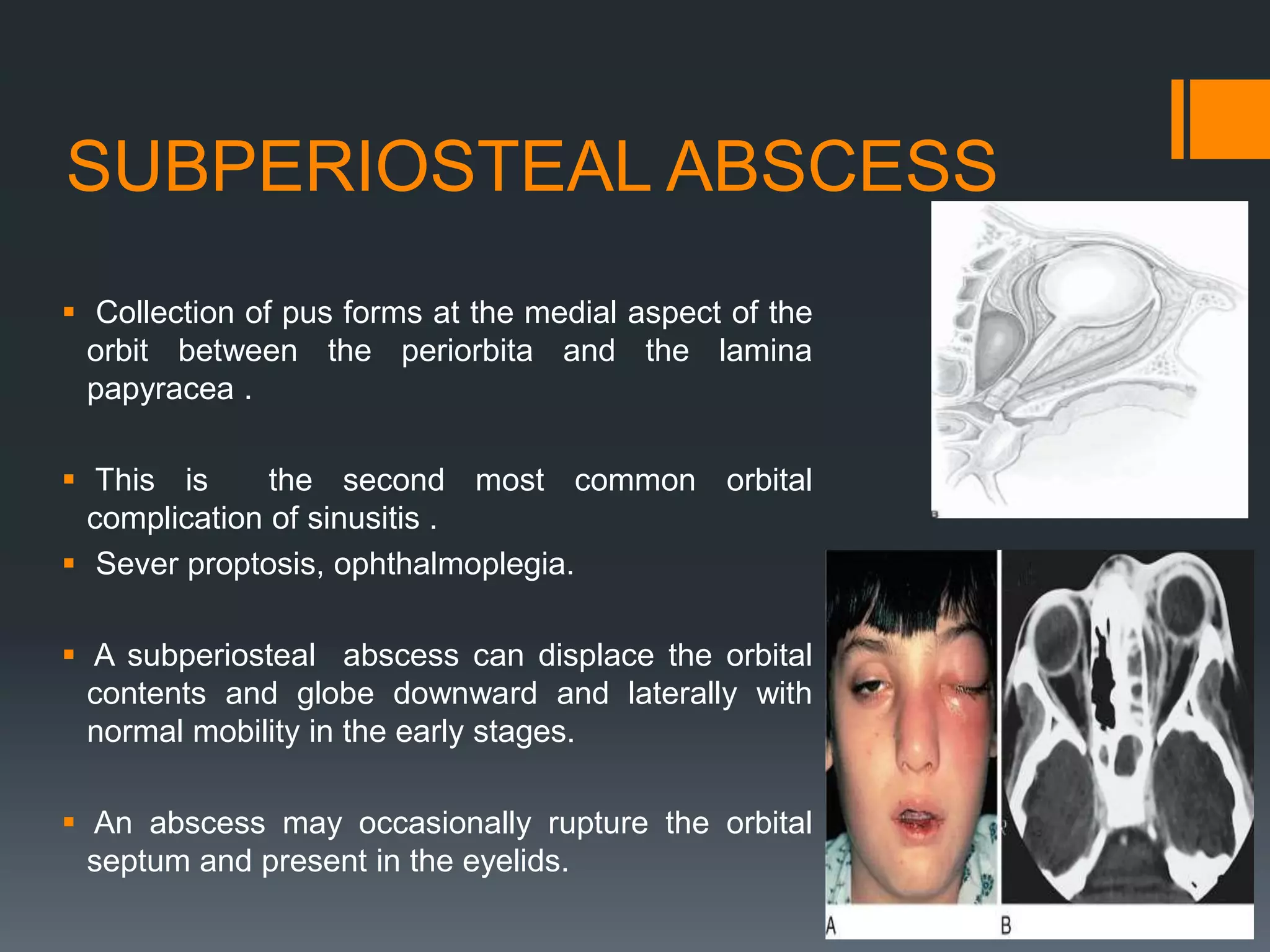Orbital complications of acute Rhinosinusitis | PPTX