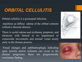 Orbital complications of acute Rhinosinusitis | PPTX