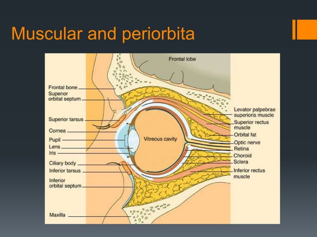 Orbital complications of acute Rhinosinusitis | PPTX