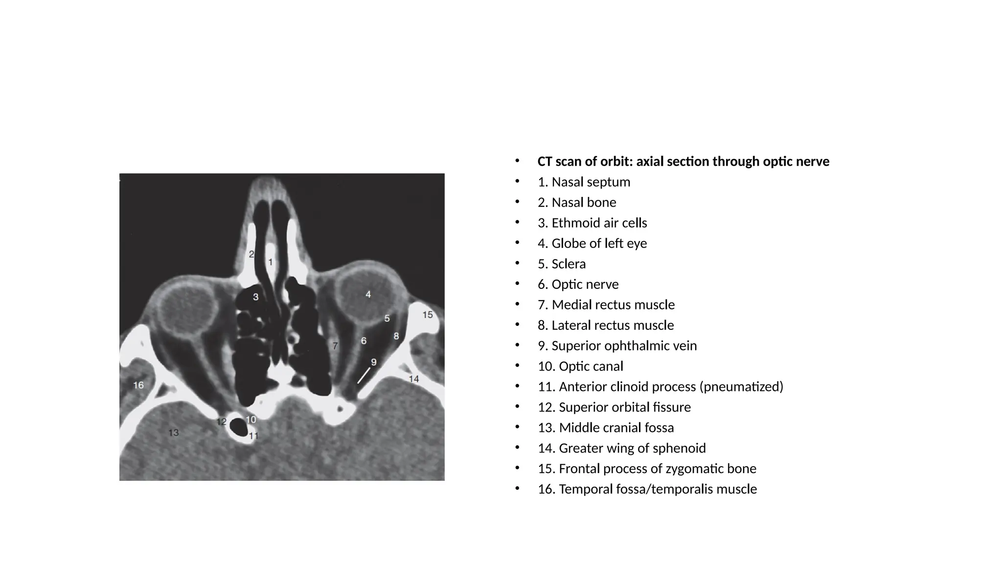 Orbital contents and eyeballgvhGGJAyWiwgwkwyyuwyw | PPTX