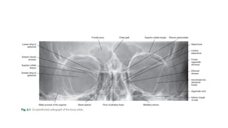 Orbital contents and eyeballgvhGGJAyWiwgwkwyyuwyw | PPTX