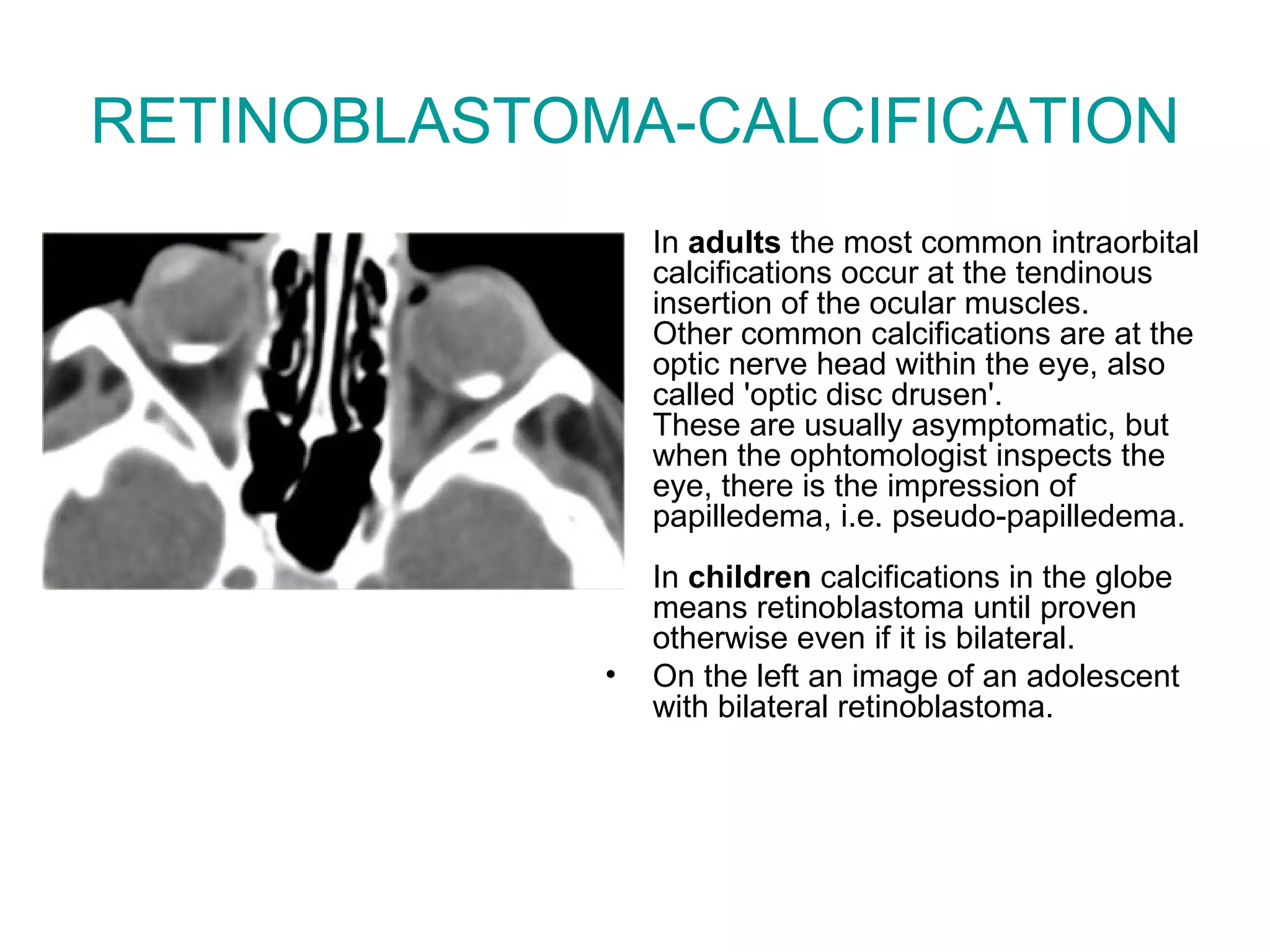 Orbital ct and mr | PPT