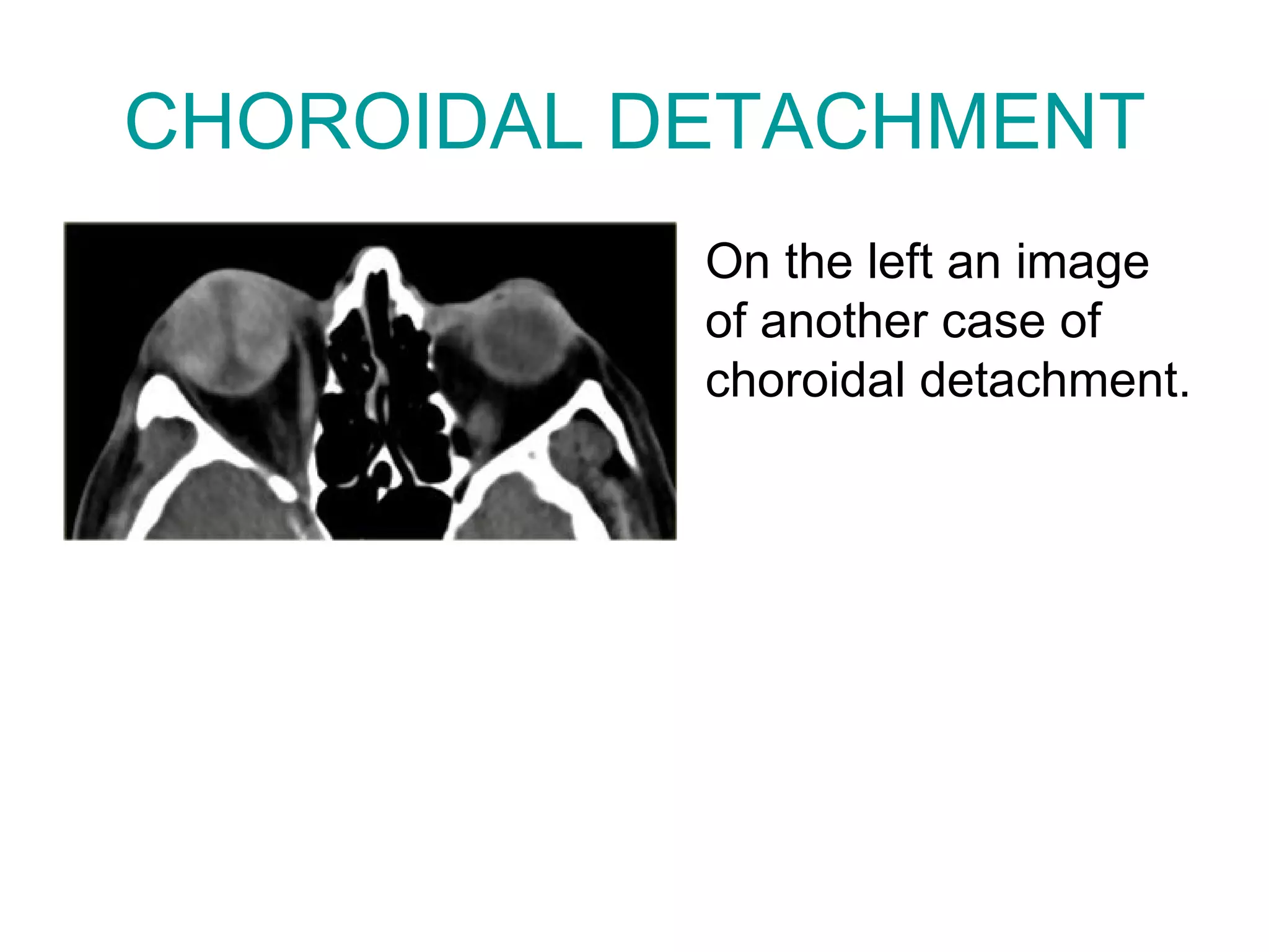 Orbital ct and mr | PPT
