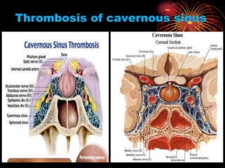 Orbital disaese lec by dr abdul basir safi | PDF