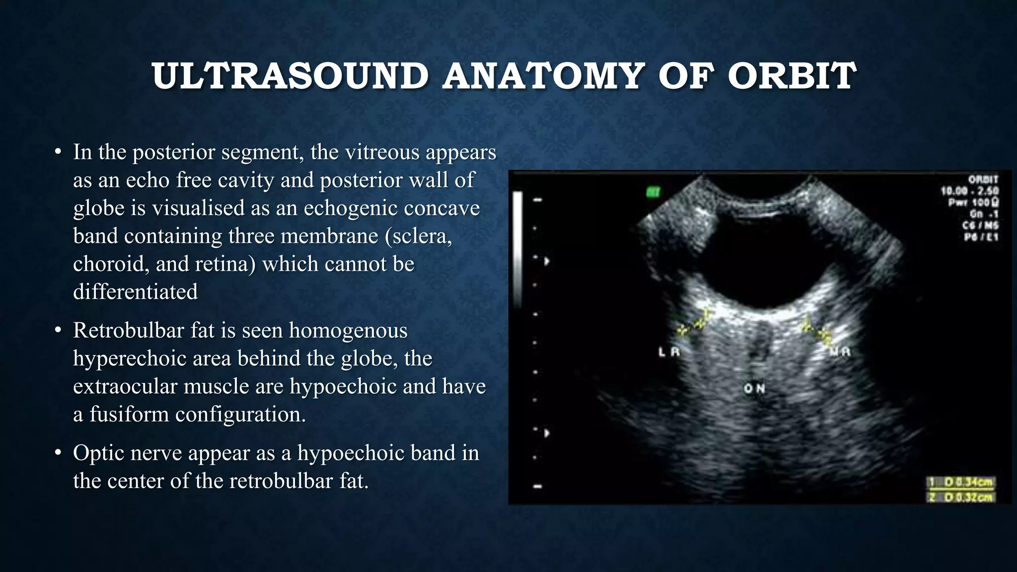 ORBITAL DOPPLER .pptx
