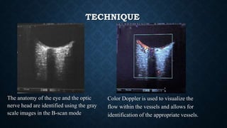 ORBITAL DOPPLER .pptx