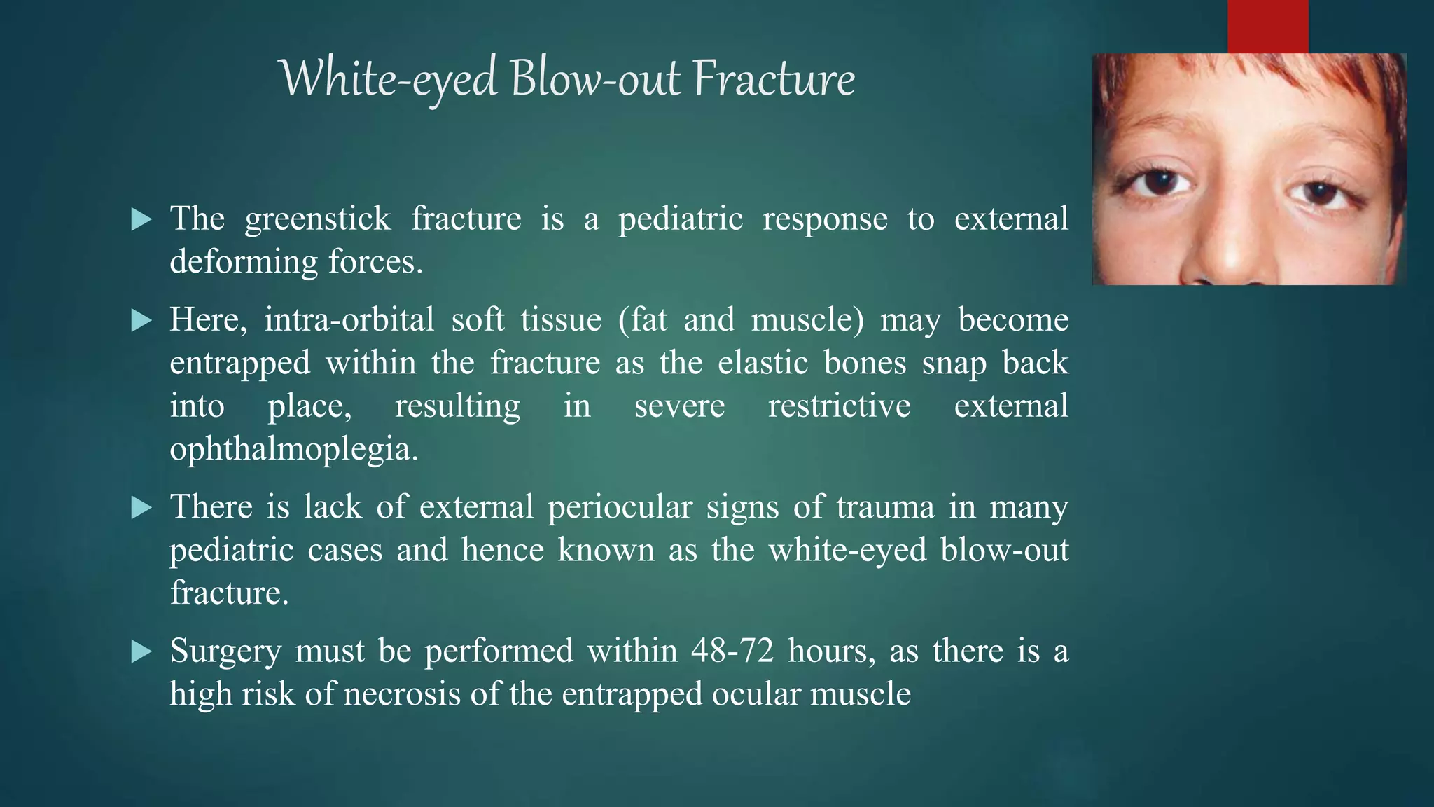 Orbital fracture | PPTX