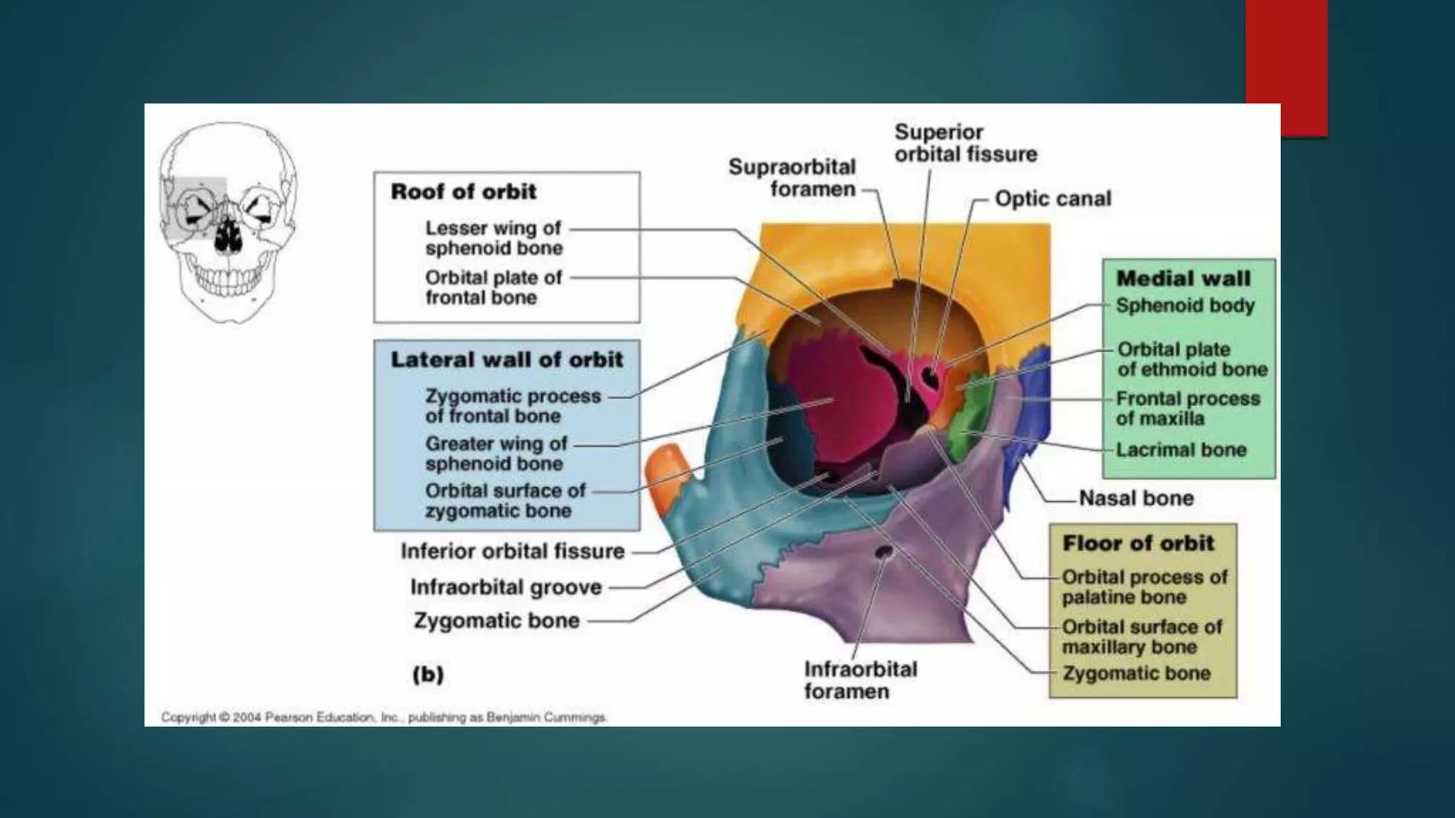 Orbital fracture | PPTX