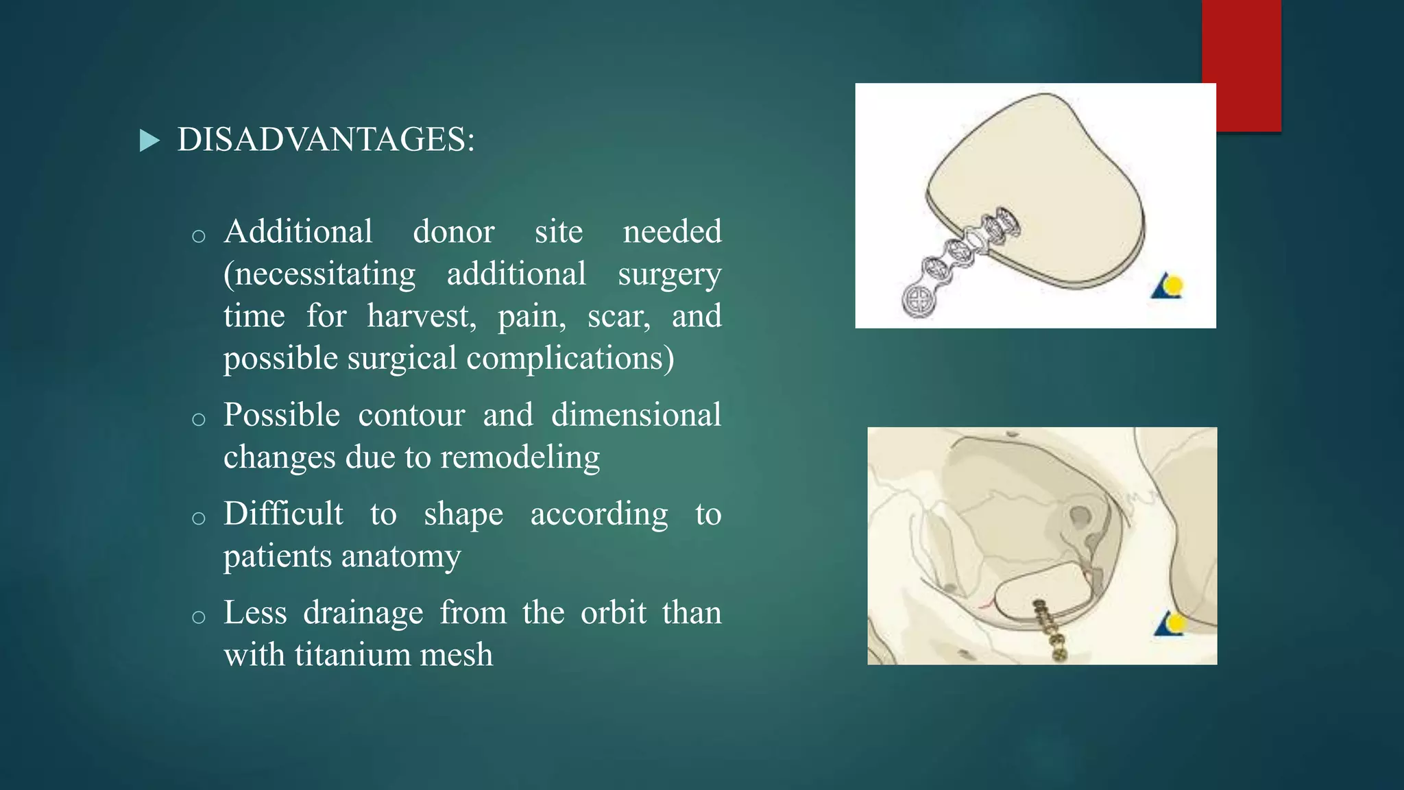 Orbital fracture | PPTX