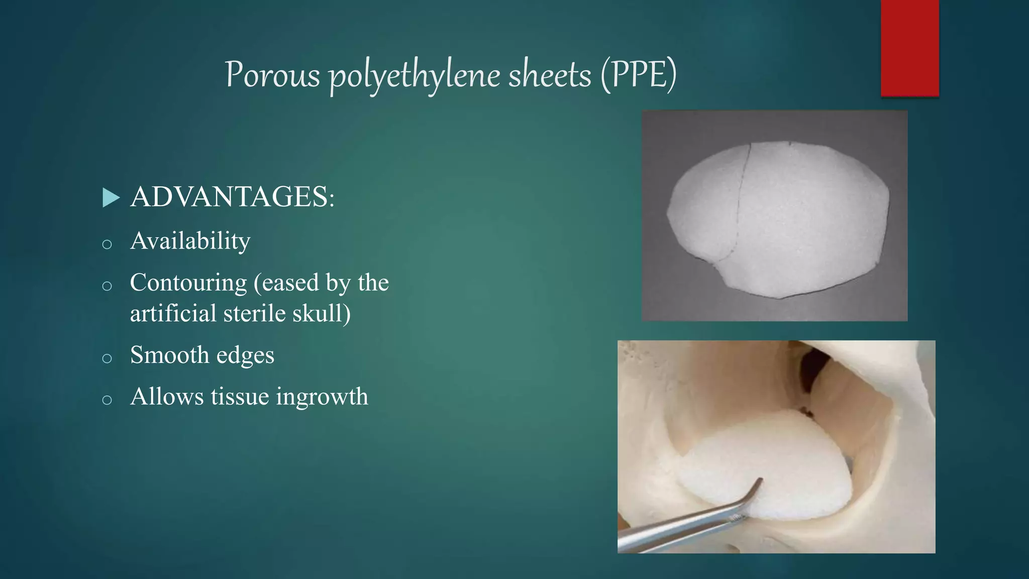 Orbital fracture | PPTX