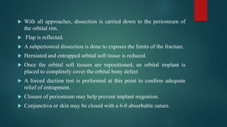 Orbital fracture | PPTX