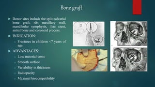 Orbital fracture | PPTX