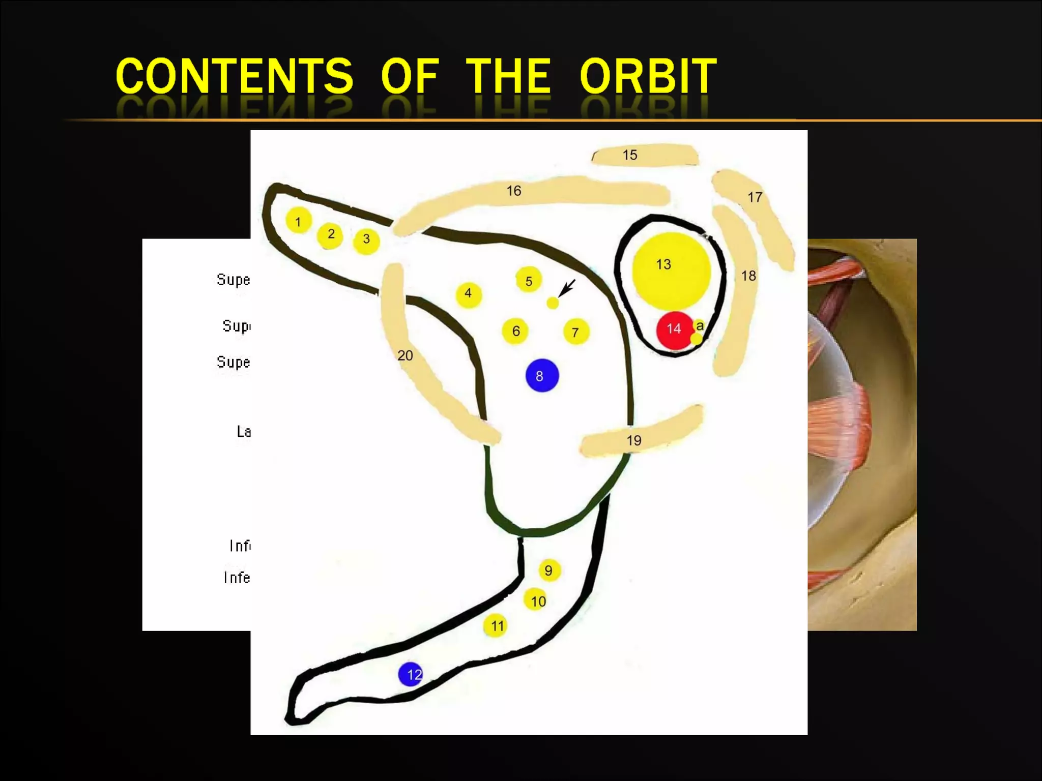 Orbital fracture | PPT