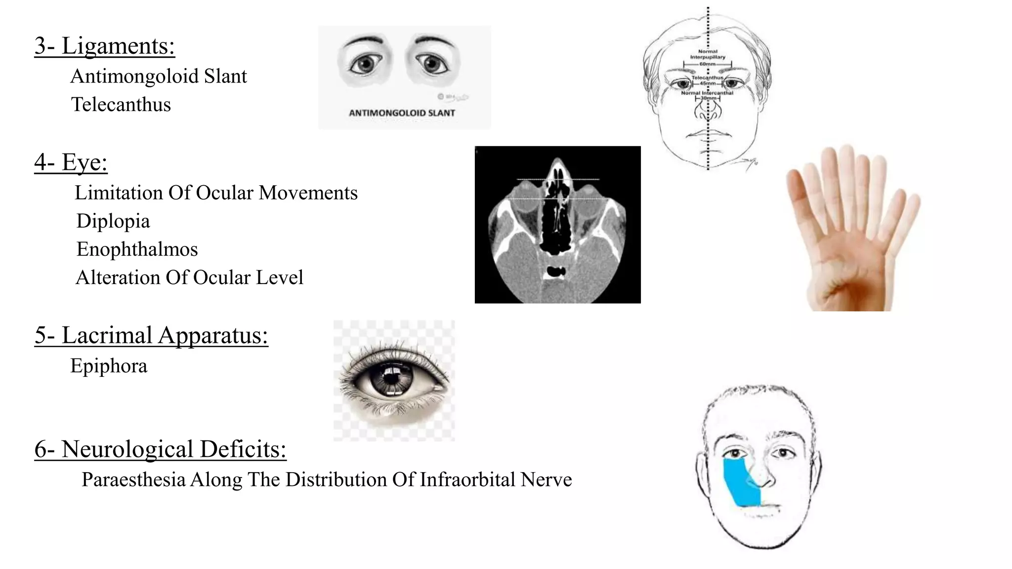 Orbital fracture management | PPTX