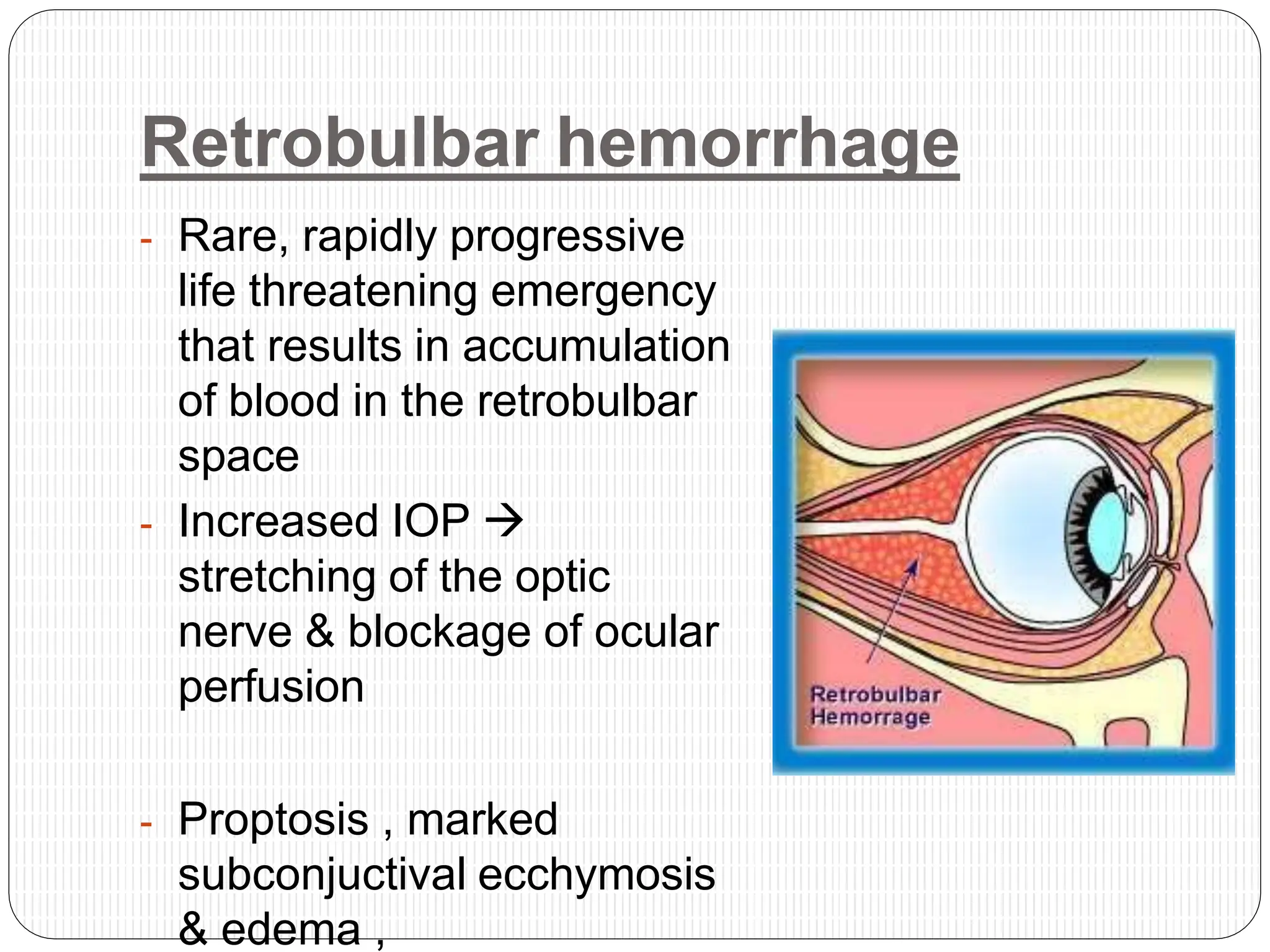 Orbital Fractures | PPTX