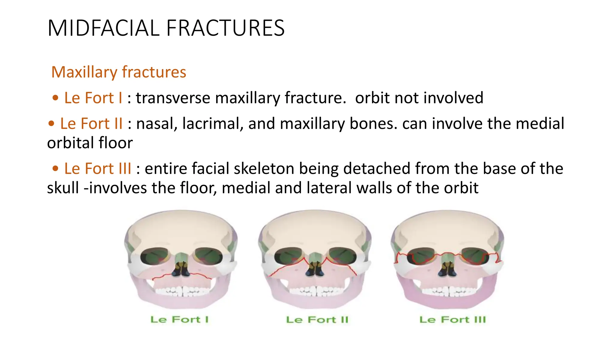ORBITAL FRACTURES.pptx