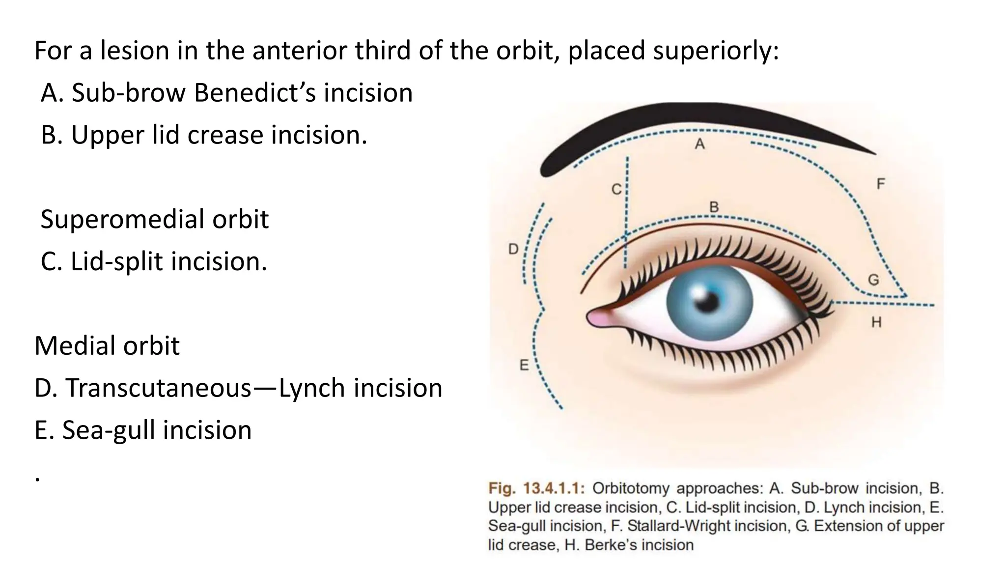 ORBITAL FRACTURES.pptx