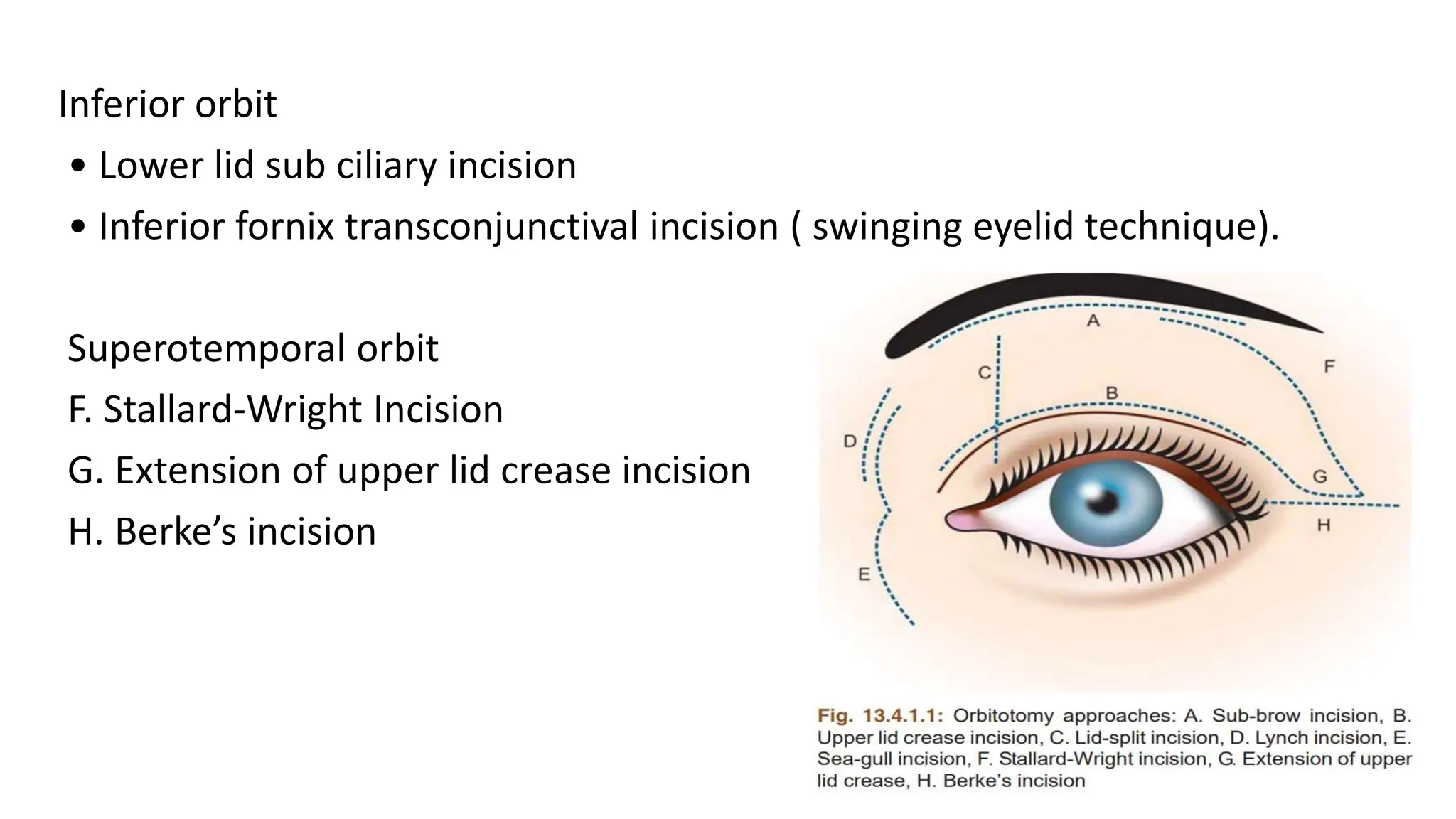 ORBITAL FRACTURES.pptx