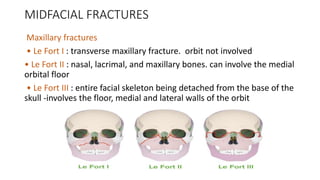 ORBITAL FRACTURES.pptx