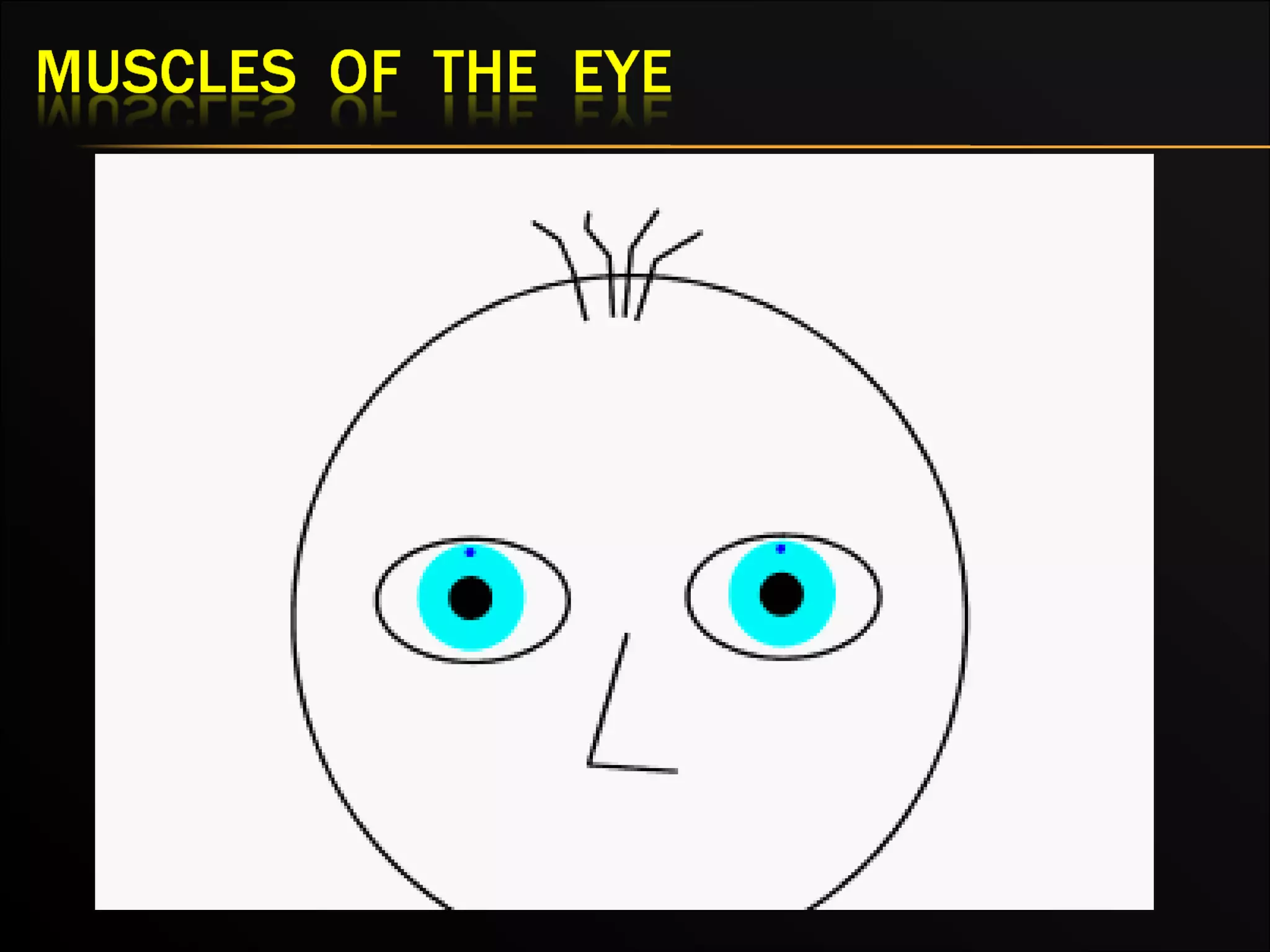 Orbital Fractures Ih Ppt