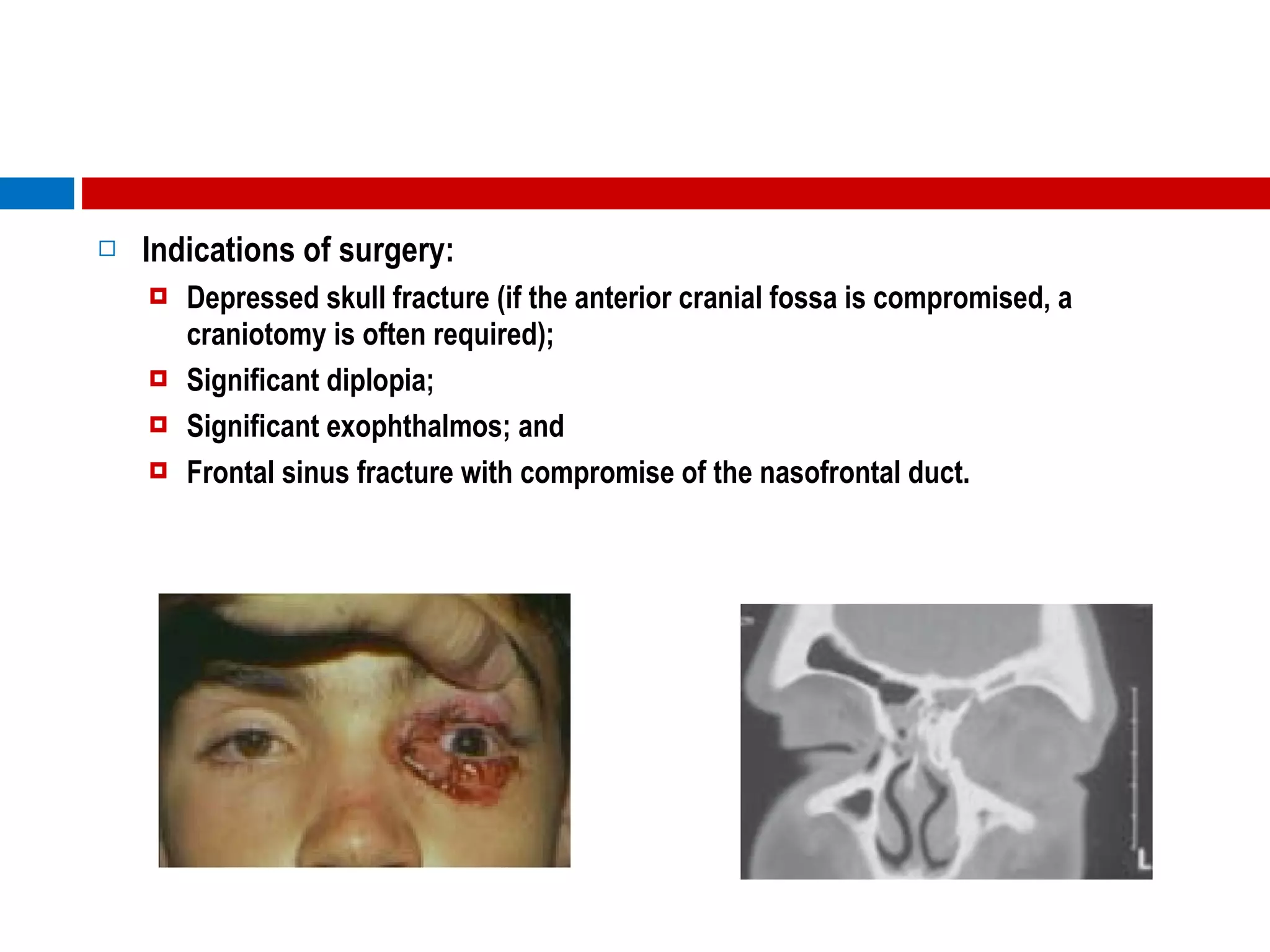 Orbital Fractures - The Role of an Ophthalmologist | PPT