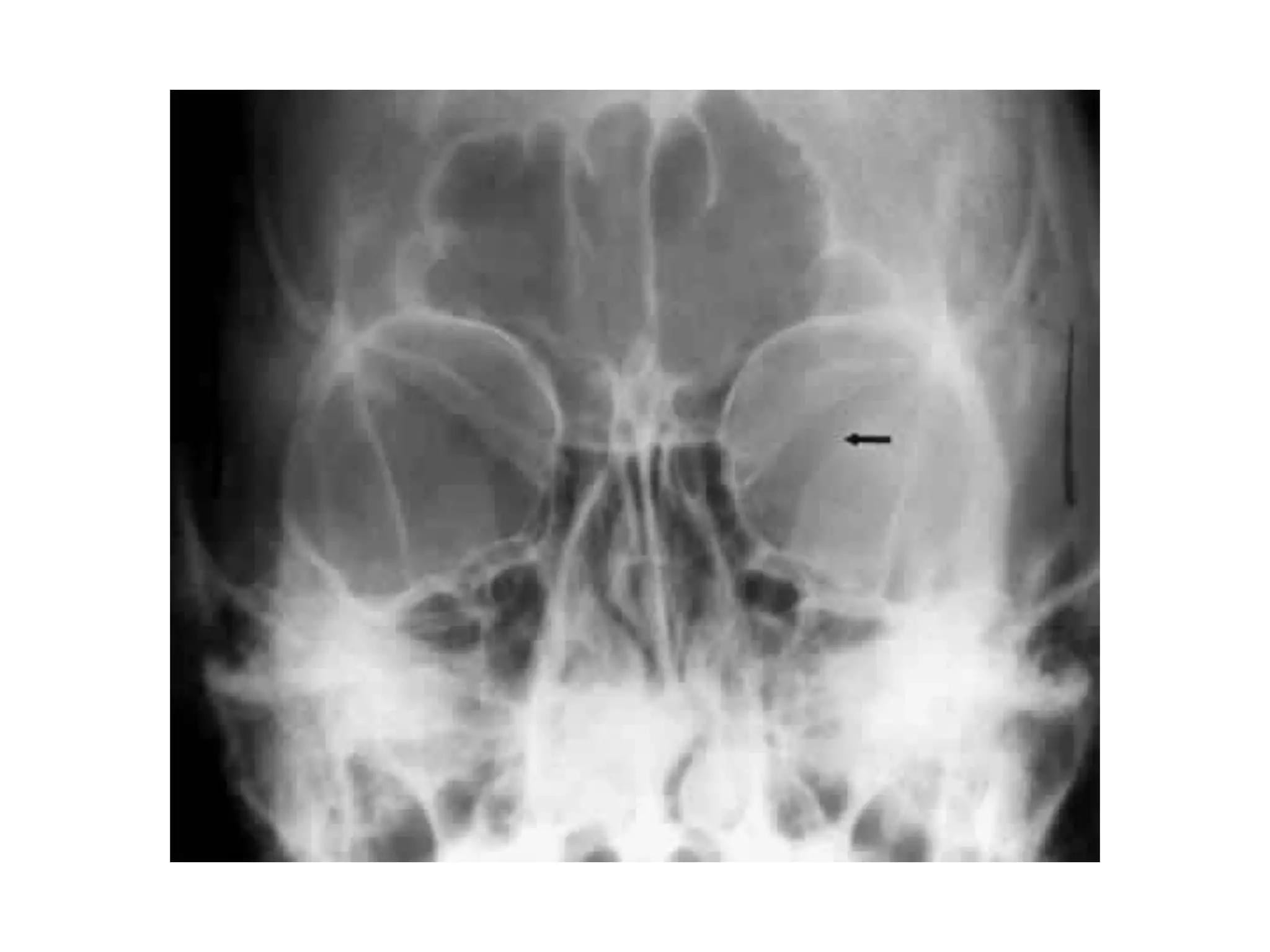 Orbital imaging (X-RAY,CT SCAN,AND MRI) | PPT