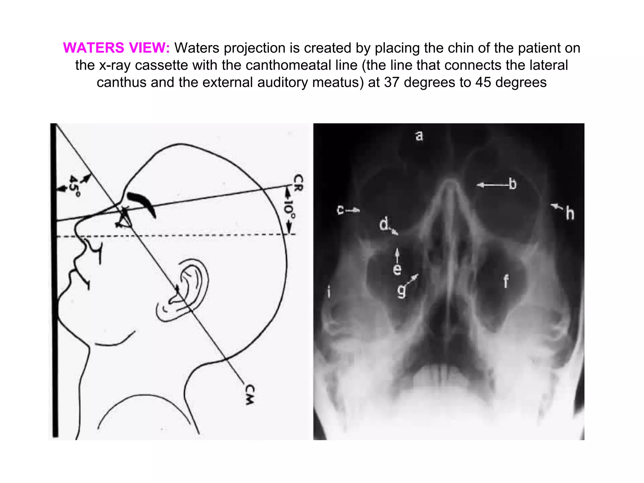 Orbital imaging (X-RAY,CT SCAN,AND MRI) | PPT