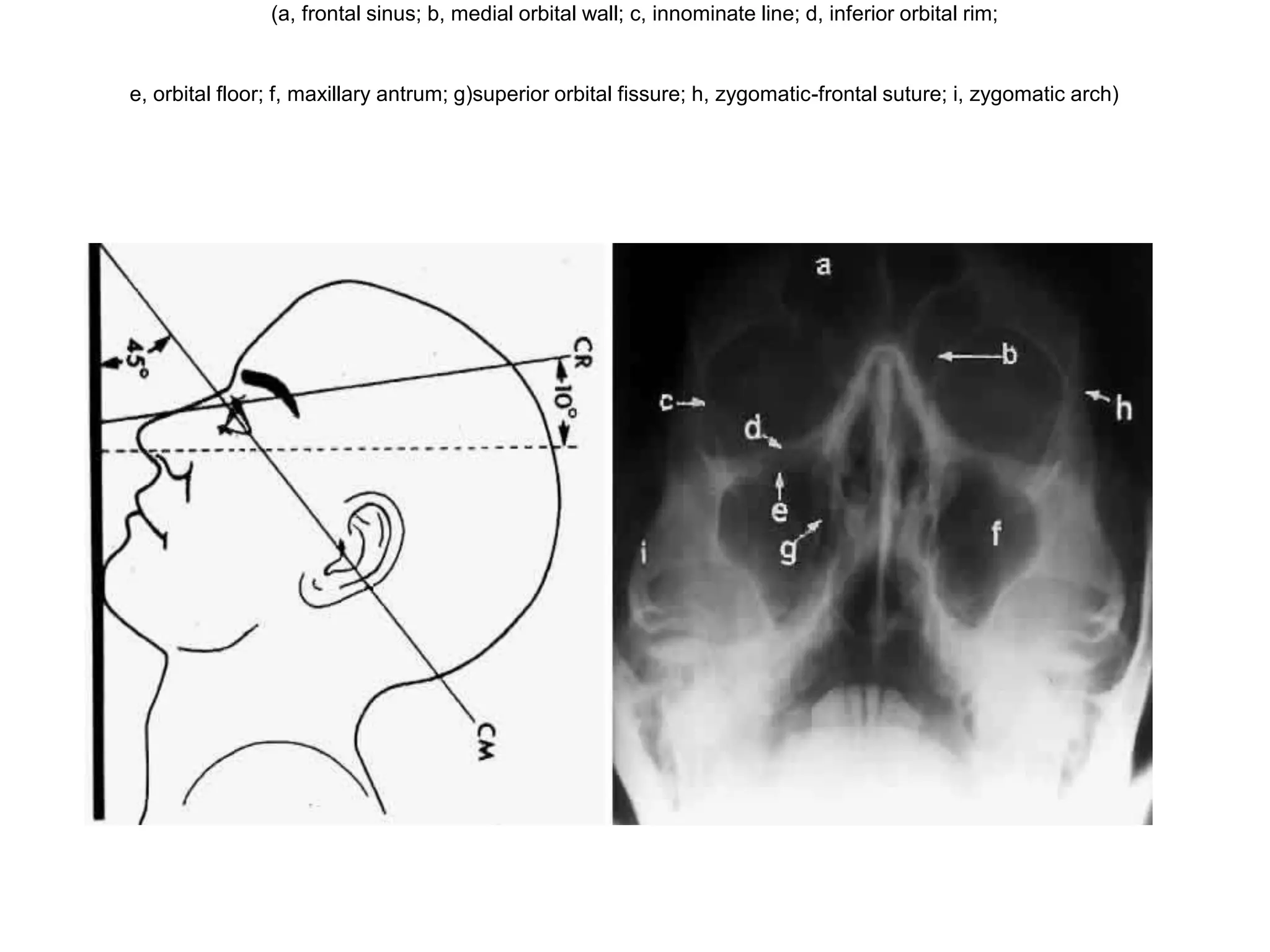 Orbital imaging (X-RAY,CT SCAN,AND MRI) | PPT