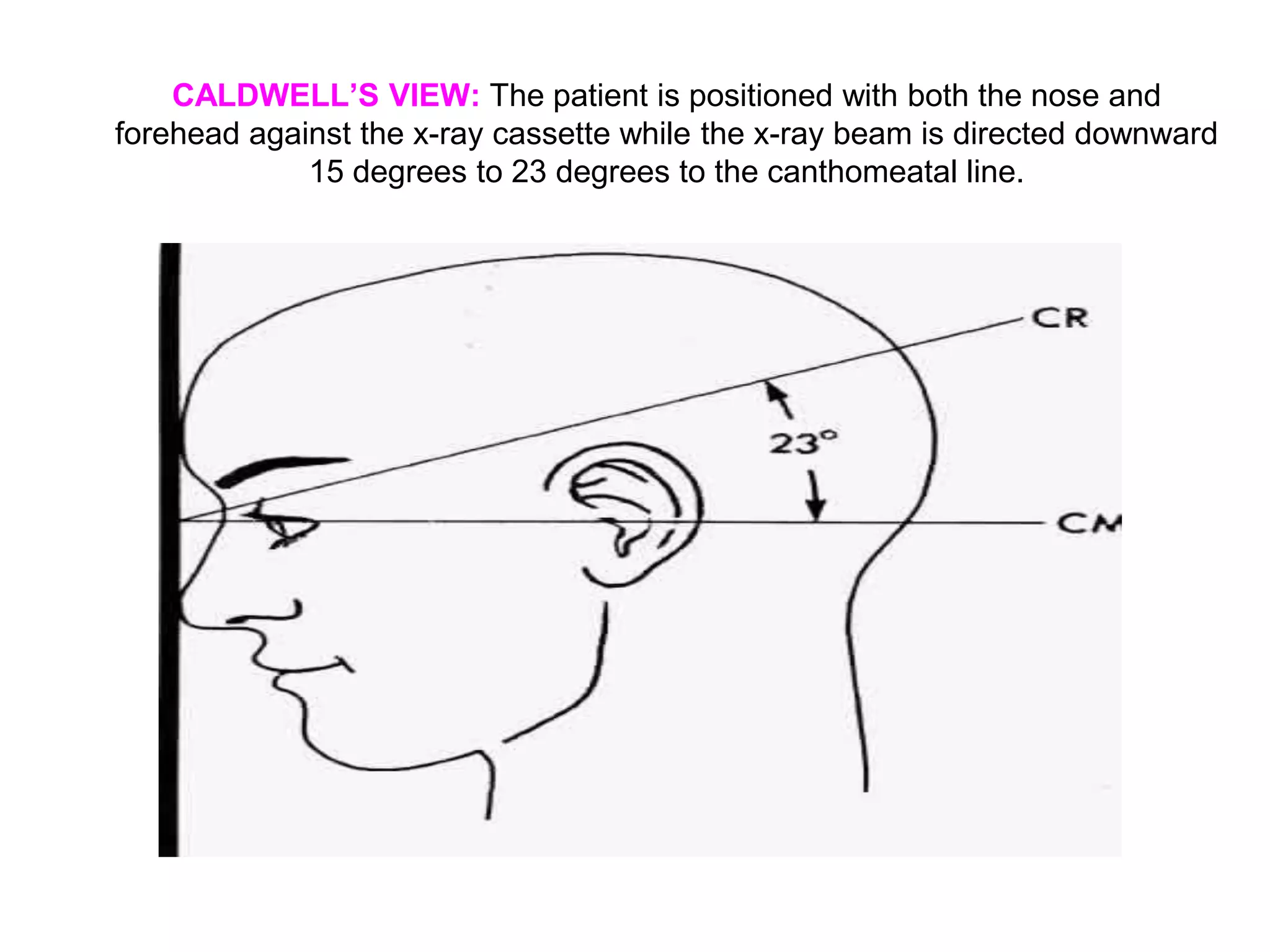Orbital imaging (X-RAY,CT SCAN,AND MRI) | PPT