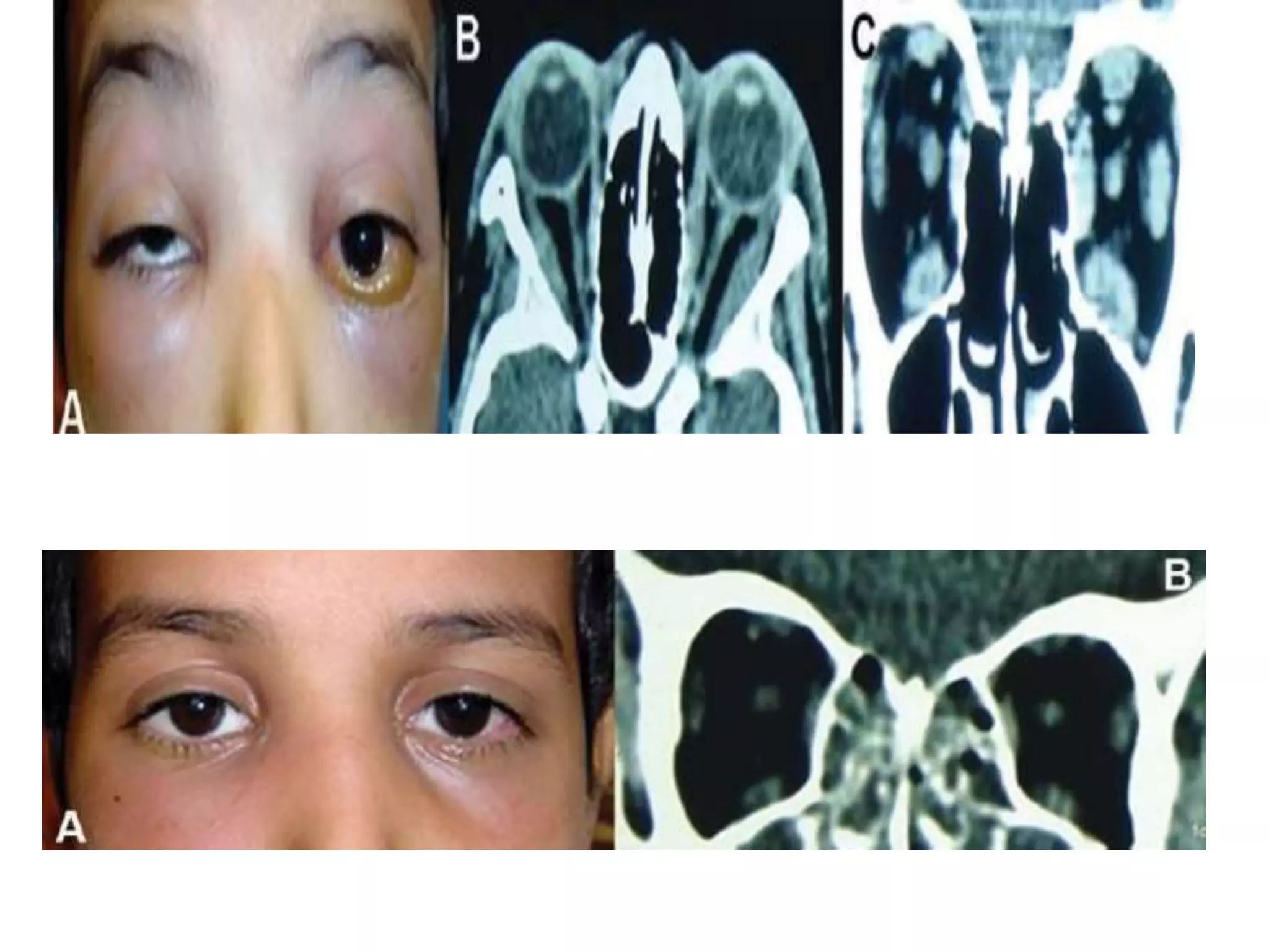Orbital imaging (X-RAY,CT SCAN,AND MRI) | PPT