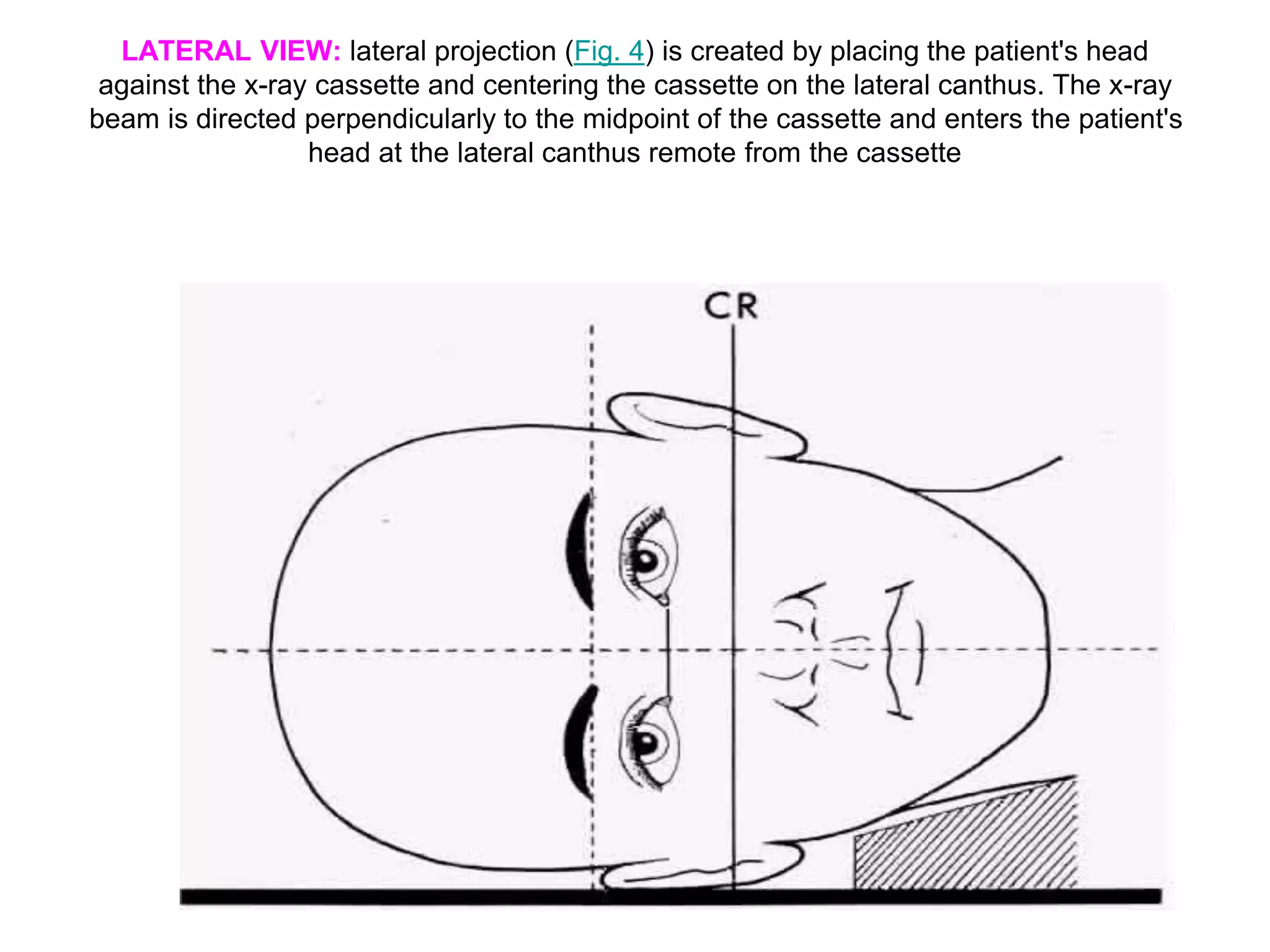 Orbital imaging (X-RAY,CT SCAN,AND MRI) | PPT