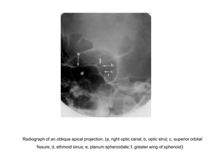 Orbital imaging (X-RAY,CT SCAN,AND MRI) | PPT