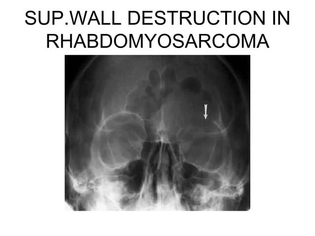 Orbital imaging (X-RAY,CT SCAN,AND MRI) | PPT | Eye and Vision ...