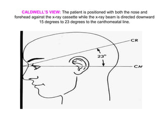 Orbital imaging (X-RAY,CT SCAN,AND MRI) | PPT