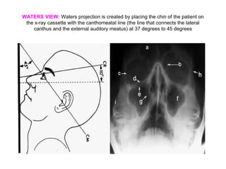 Orbital imaging (X-RAY,CT SCAN,AND MRI) | PPT
