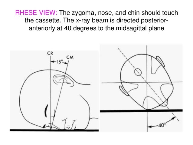 Orbital imaging (X-RAY,CT SCAN,AND MRI)