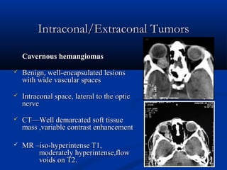 Orbital imaging | PPT