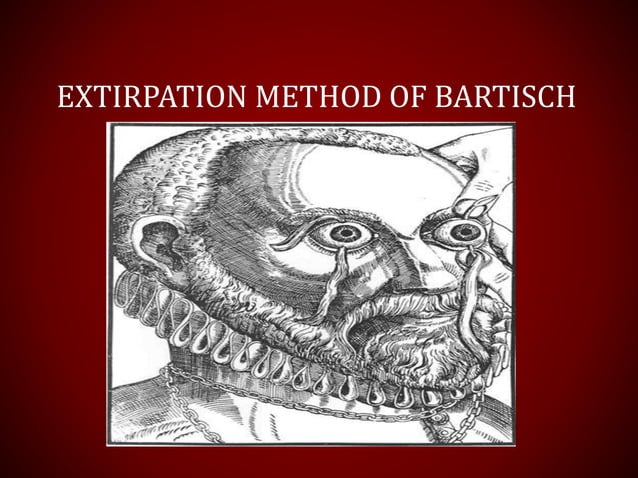 Orbital implants | PPTX | Eye and Vision Conditions | Diseases and ...