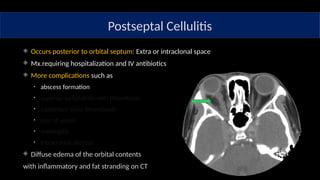 Orbital infection and inflamation new.pptx