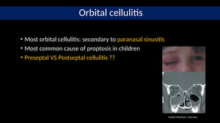 Orbital infection and inflamation new.pptx