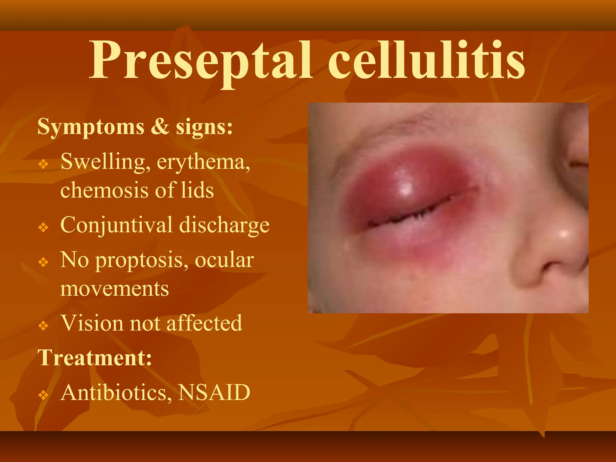 ORBITAL INFLAMMATION powerpoint presentation | PPTX