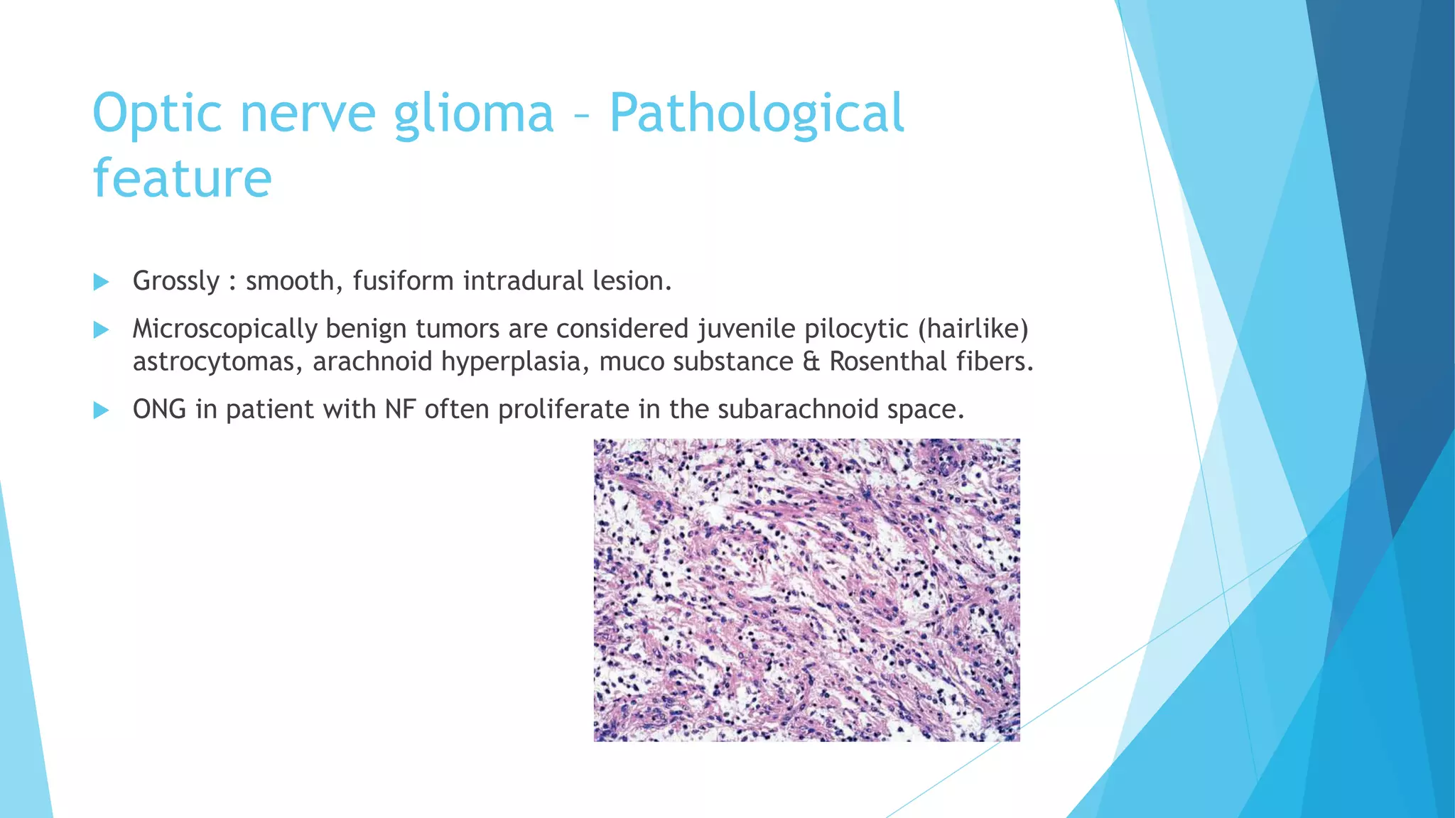 Orbital neoplasms & malformations | PPT