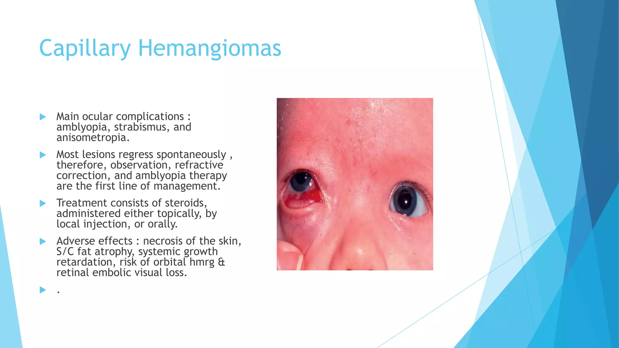 Orbital neoplasms & malformations | PPTX