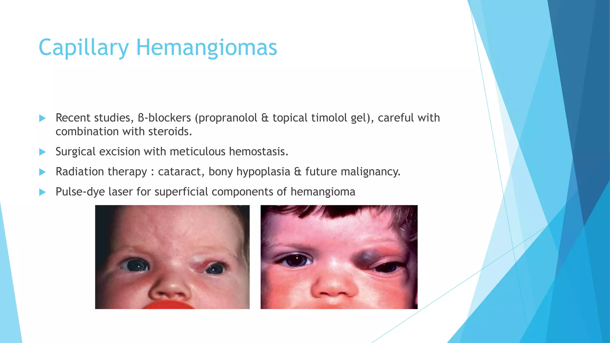 Orbital neoplasms & malformations | PPTX