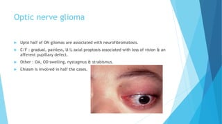 Orbital neoplasms & malformations | PPTX