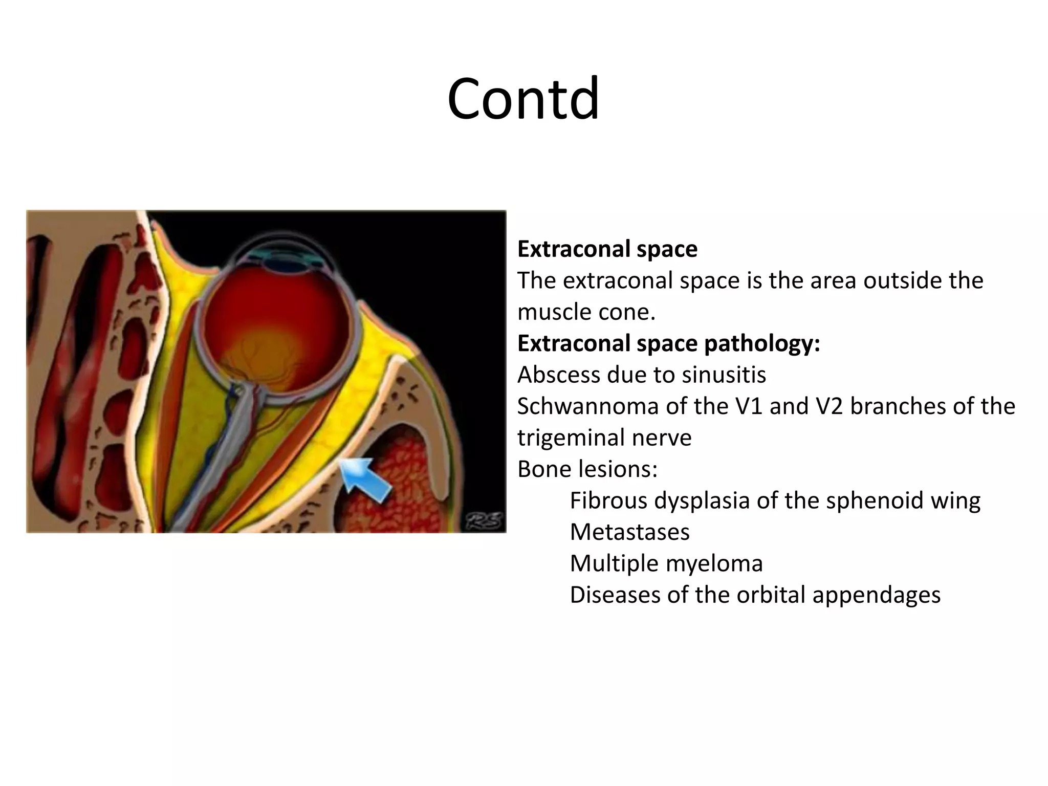 Imaging in orbital pathology | PPTX