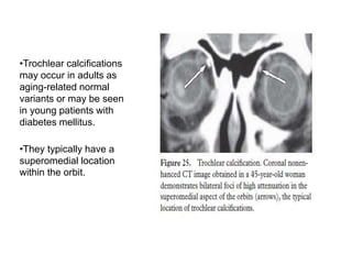 Imaging in orbital pathology | PPTX